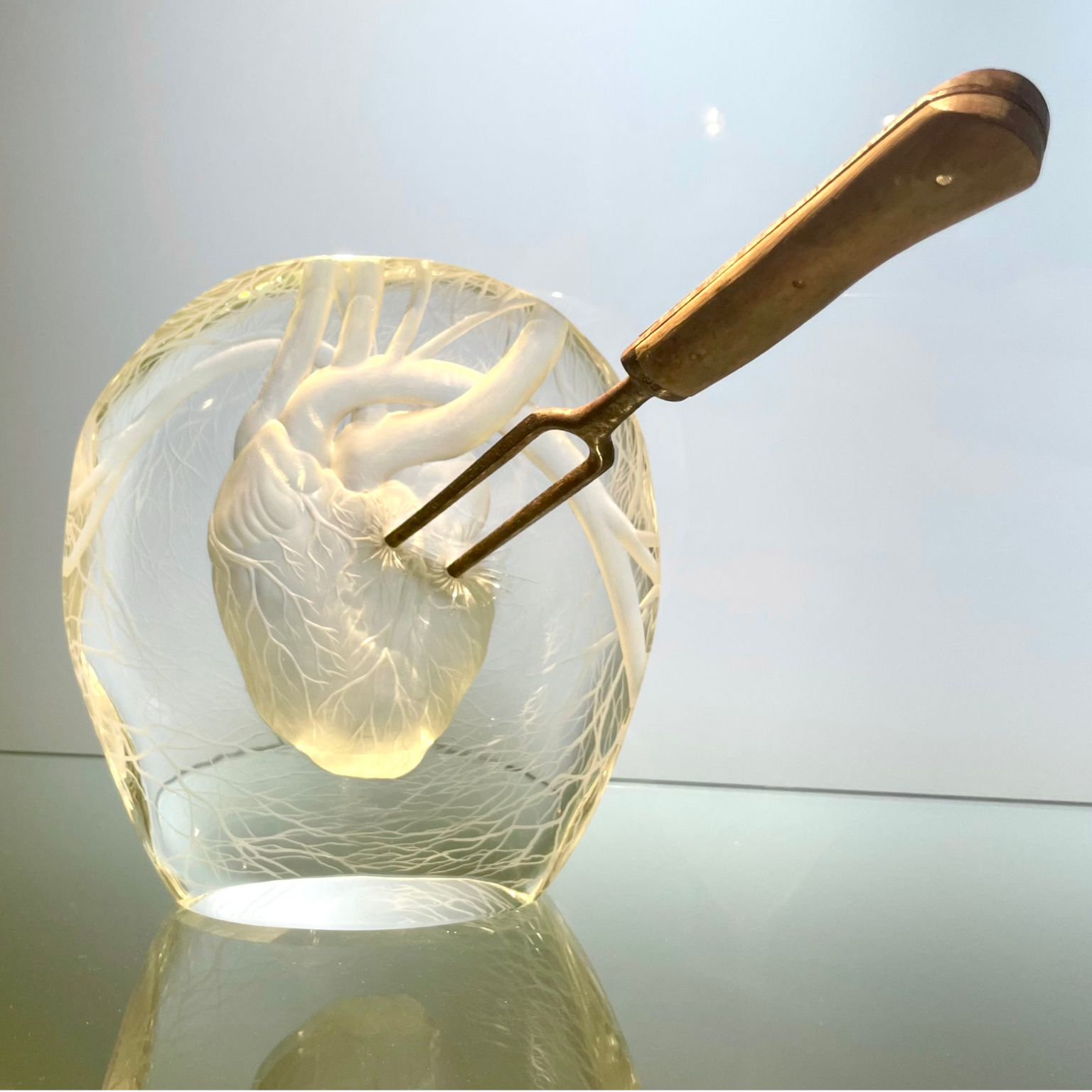 Kleine Sonderausstellung „Herzakupunktur“ von Jan Schindler ...